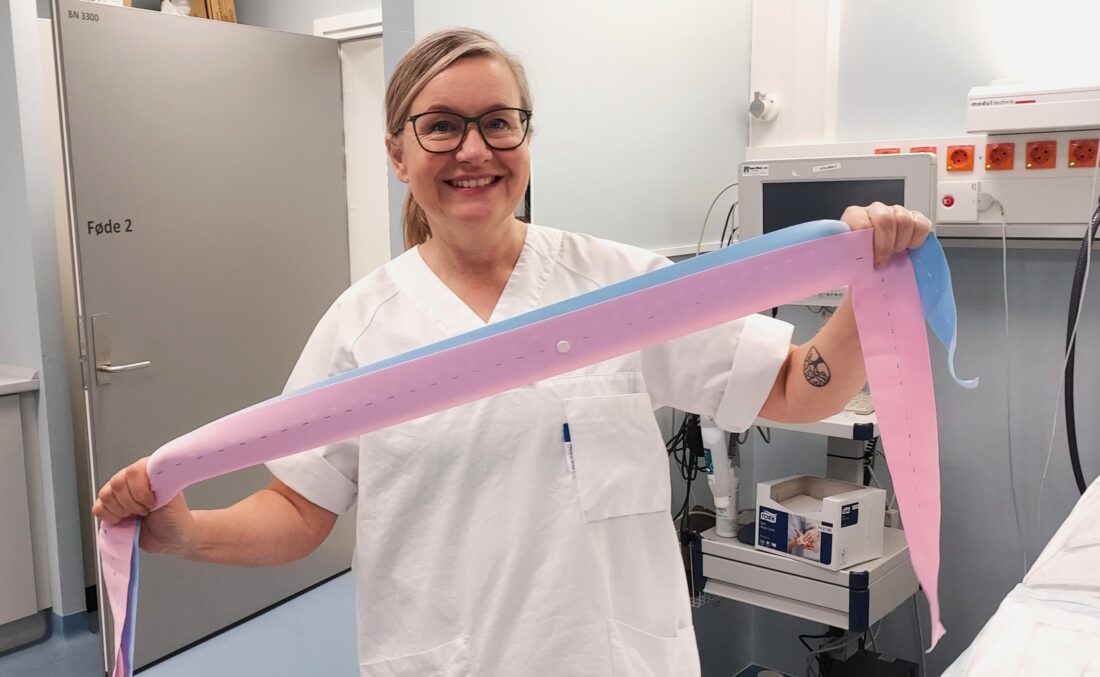 CTG: an essential tool in obstetric care and pregnancy monitoring ...